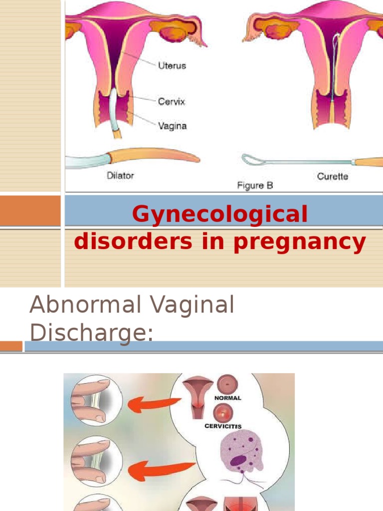 Gynecological Disorders and Their Management During Pregnancy, Labor ...