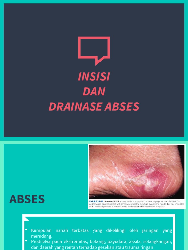 Insisi Dan Drainase Abses | PDF