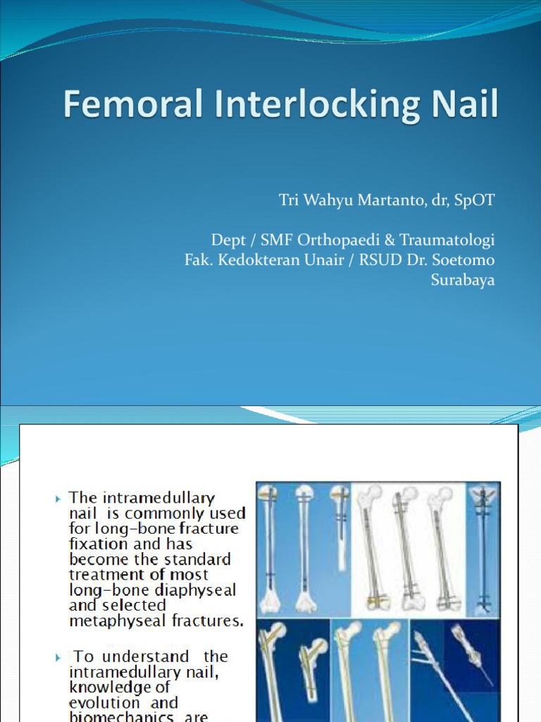 Femoral Interlocking | PDF | Knee | Musculoskeletal System