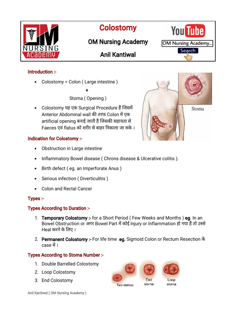 Colostomy | PDF