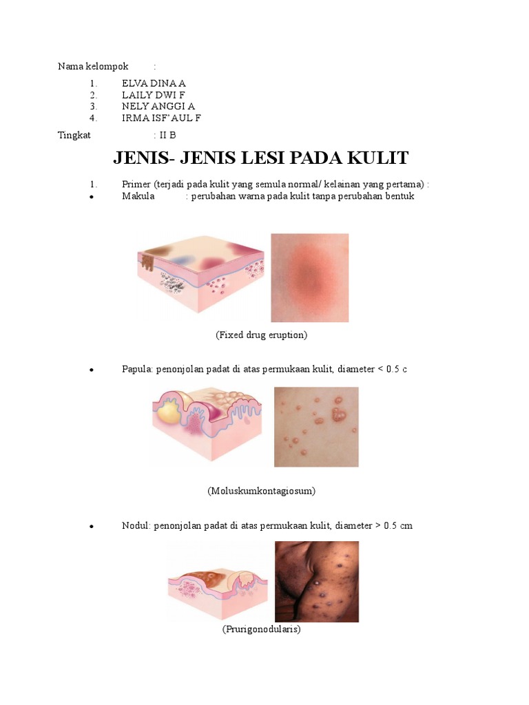 Lesi Sekunder Pada Kulit | PDF