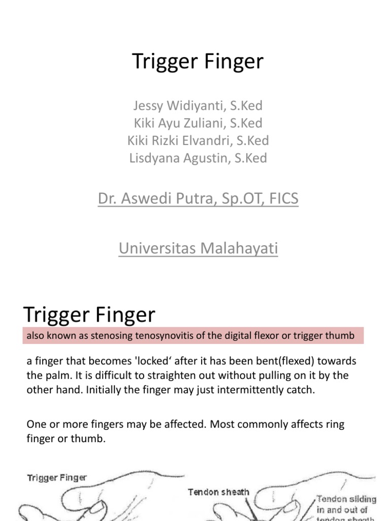 Trigger Finger: Dr. Aswedi Putra, SP - OT, FICS Universitas Malahayati | PDF | Finger | Hand