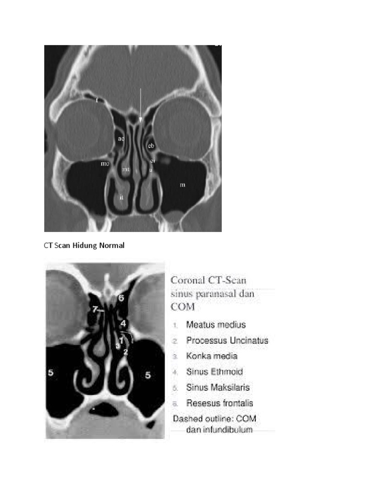 CT Scan | PDF