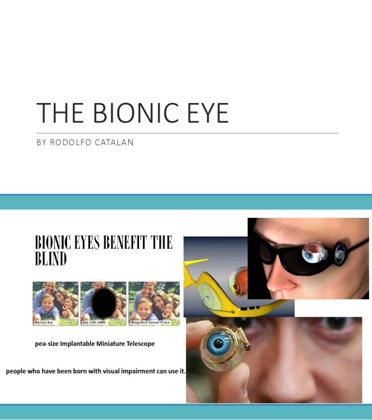 The Bionic Eye | PDF