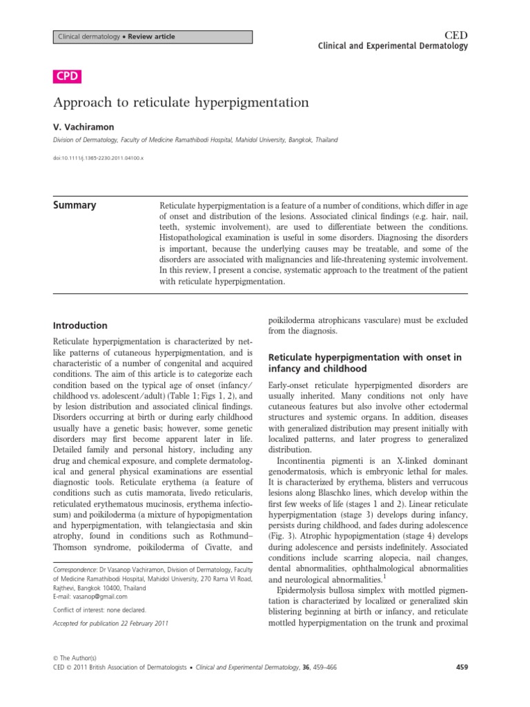 Approach To Reticulate Hyperpigmentation: Clinical Dermatology - Review ...
