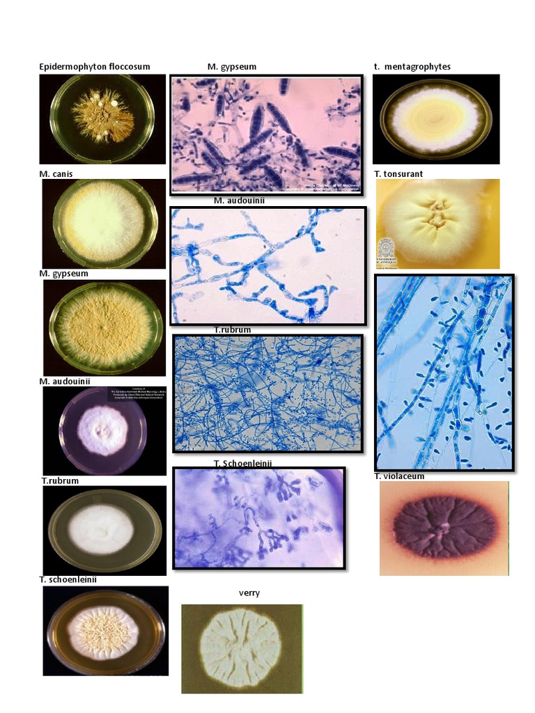 Epidermophyton Floccosum | PDF
