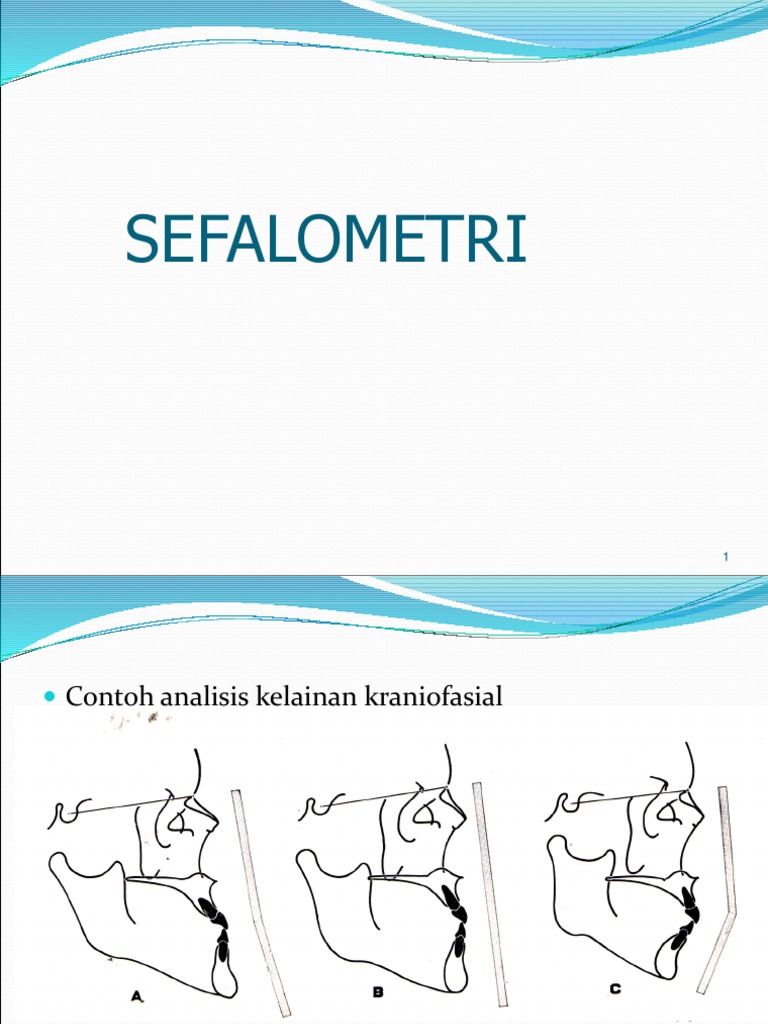Sefalometri | PDF