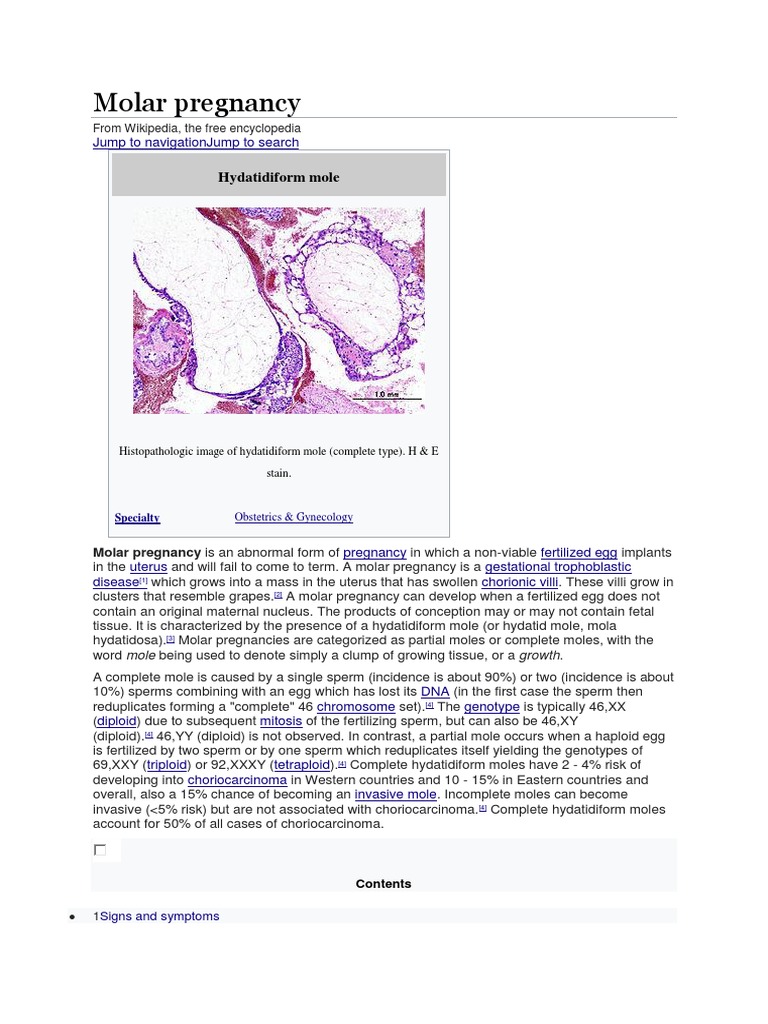 Molar Pregnancy | PDF | Human Reproduction | Medical Specialties