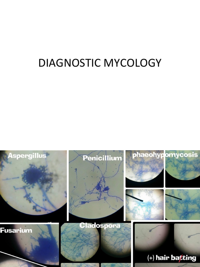 A Comprehensive Guide to Diagnostic Mycology: Specimen Collection ...