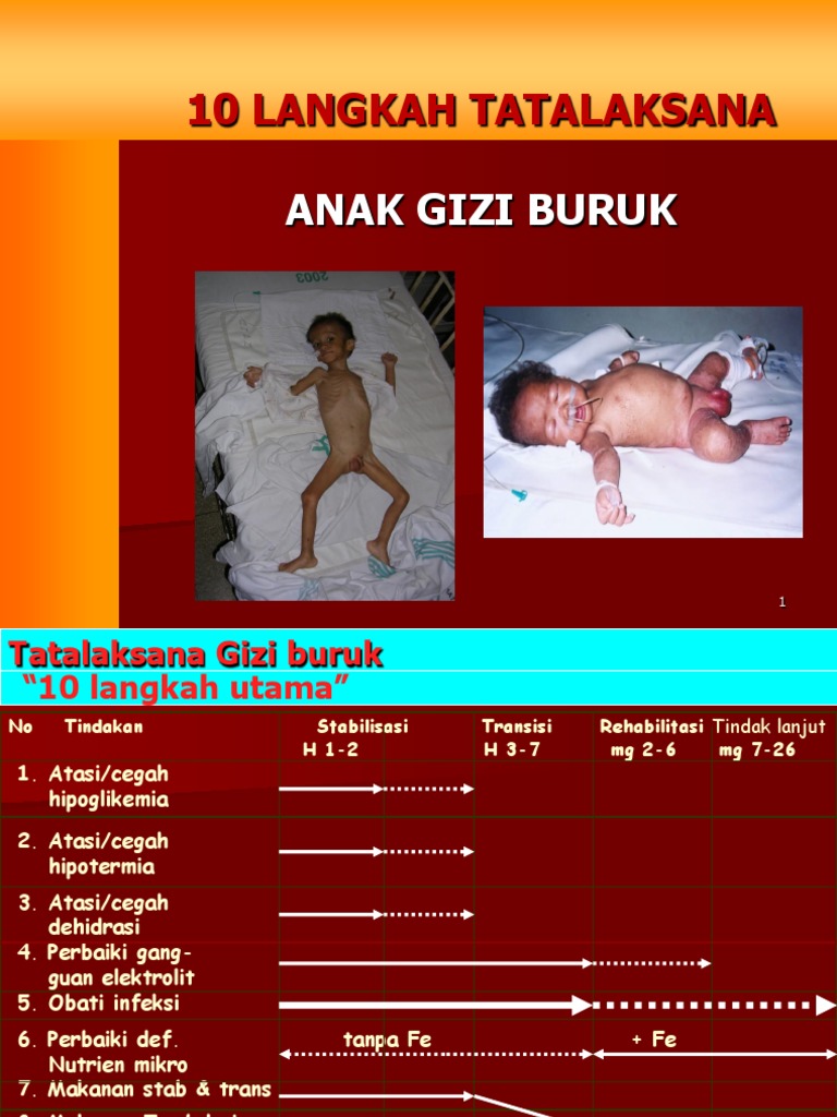Tatalaksana Gizi Buruk Terbaru | PDF | Kesehatan Holistik