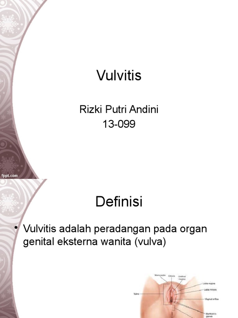 Vulvitis | PDF