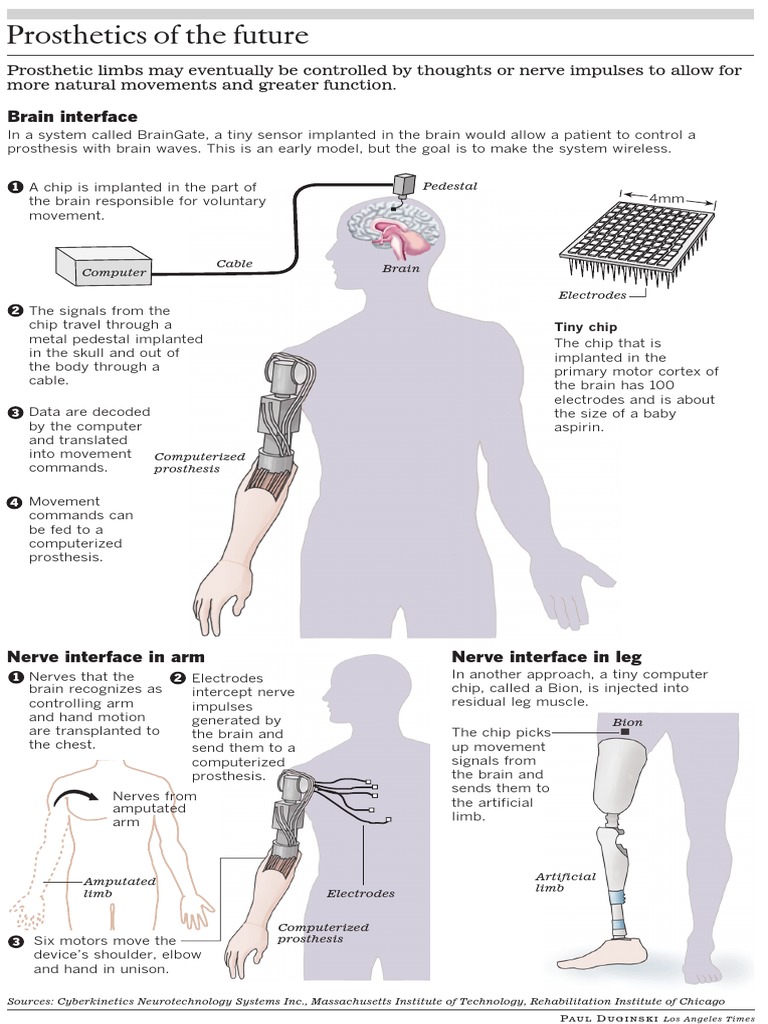 Prosthetics of The Future | PDF | Prosthesis | Brain