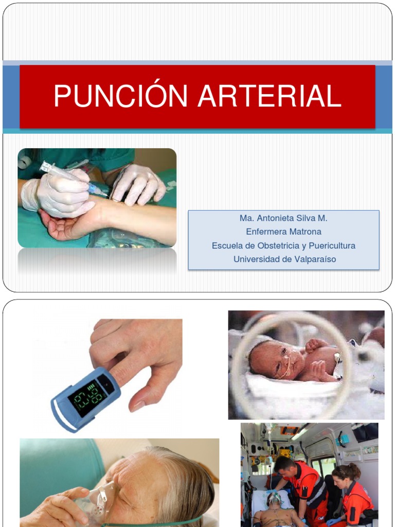 Punción Arterial | PDF | Especialidades Medicas | Fisiología