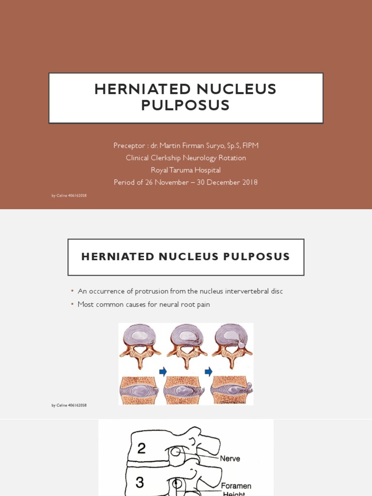 Herniated Nucleus Pulposus (HNP) | PDF | Back Pain | Symptoms And Signs
