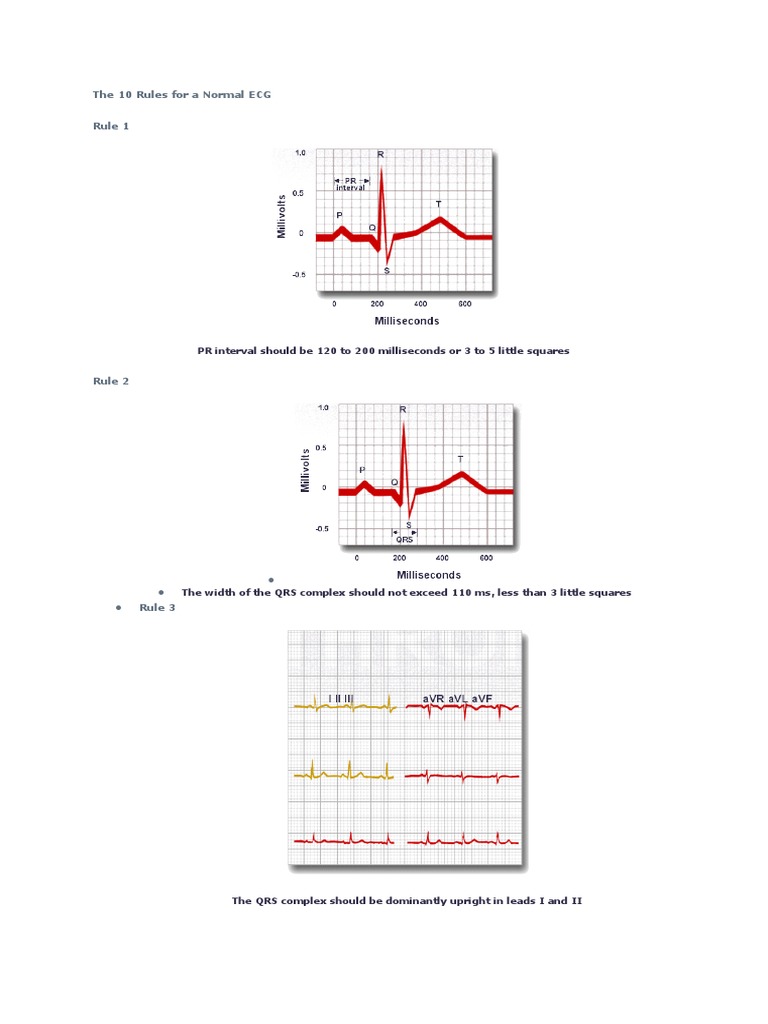The 10 Rules For A Normal ECG | PDF