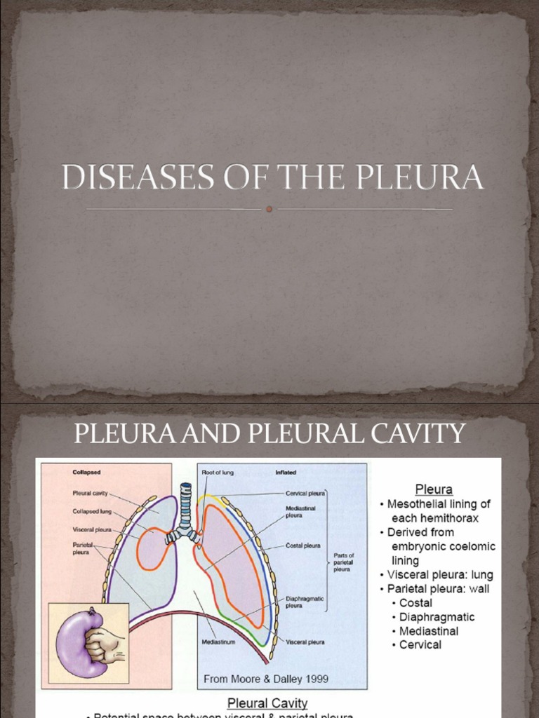 Pleuritis | PDF | Pulmonology | Epidemiology