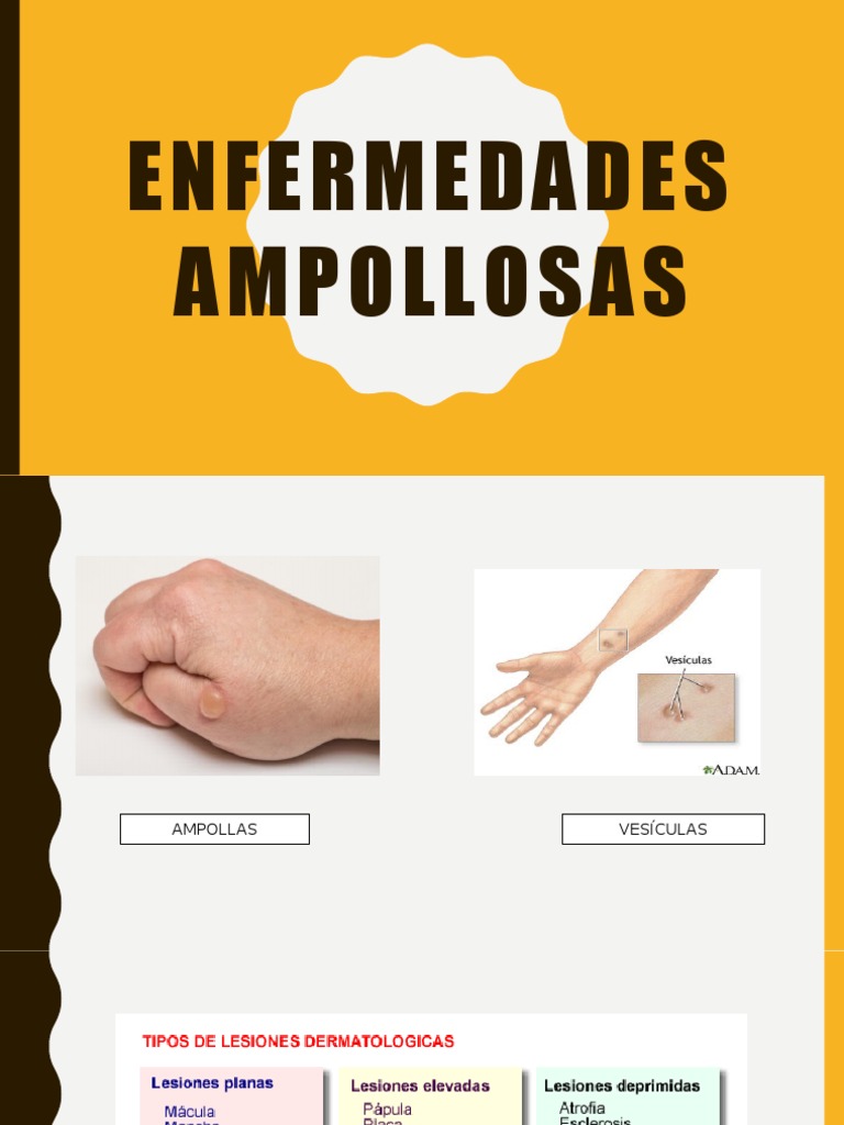 Enfermedades AMPOLLOSAS | PDF | Enfermedades y trastornos ...