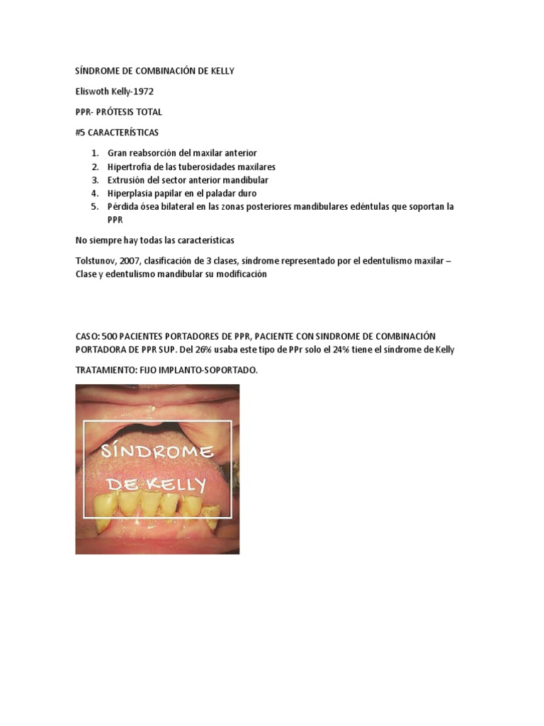 Síndrome de Combinación de Kelly | PDF
