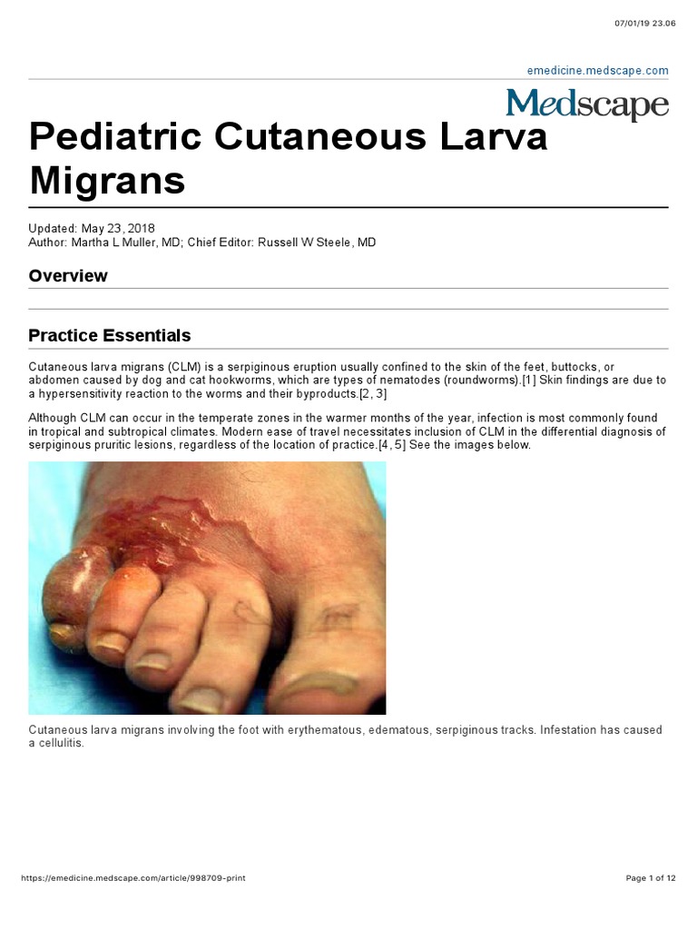 Pediatric Cutaneus of Larva Migrans | PDF | Health Sciences | Clinical ...