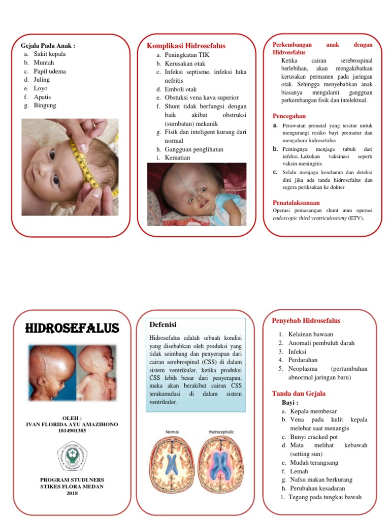 Leaflet Hidrosefalus | PDF