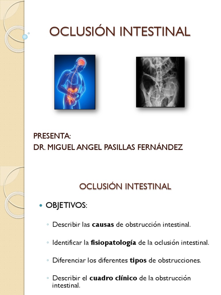 oclusion intestinal| | Gastroenterología | Especialidades Medicas