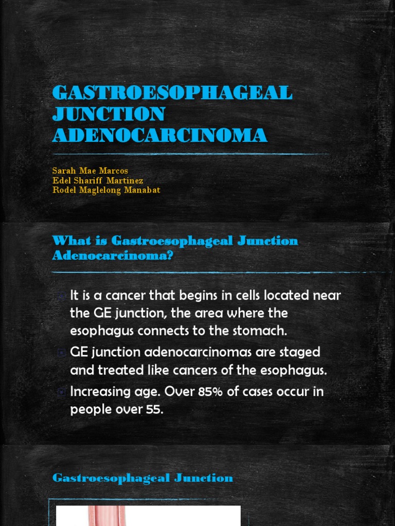 GE Junction Adenocarcinoma Overview | PDF | Esophagus ...
