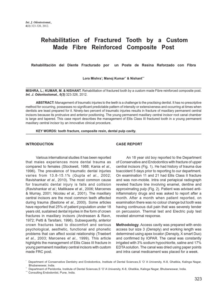 Fiber FRC Cutom Made | PDF | Dental Composite | Mouth