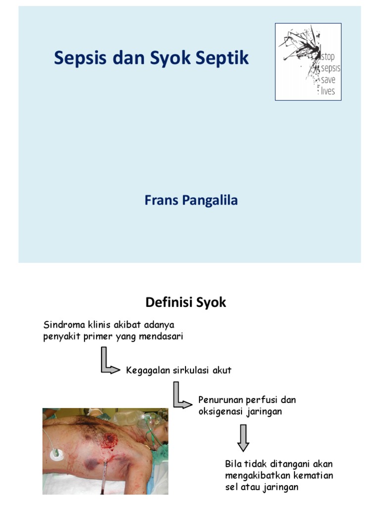 Kriteria dan Definisi Syok Sepsis | PDF | Sepsis | Peradangan