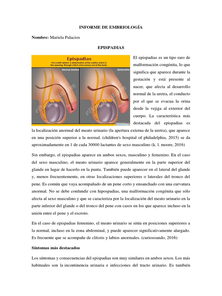 Epispadia | PDF | Sistema urinario | Órgano (anatomía)