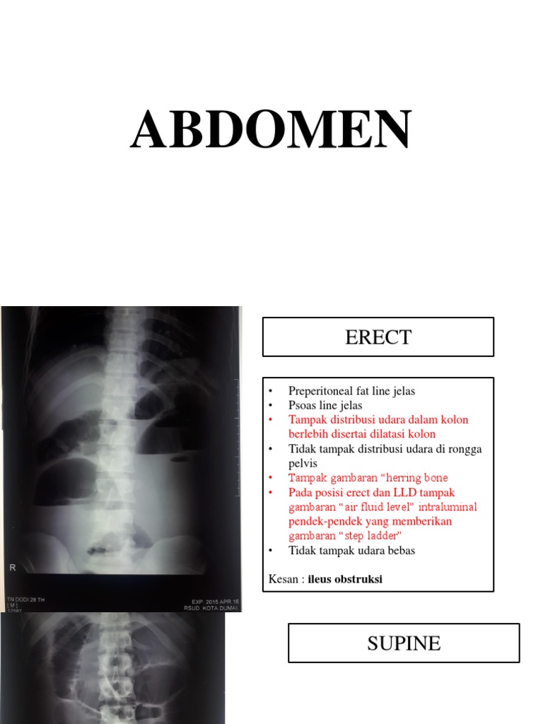 RONTGEN Abdomen | PDF