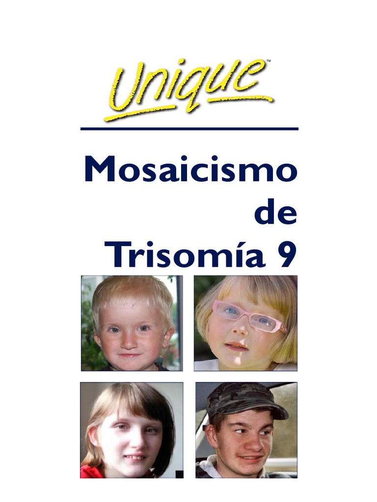Mosaicismo de Trisomia 9 Spanish FTNW | PDF | Cariotipo | Corazón