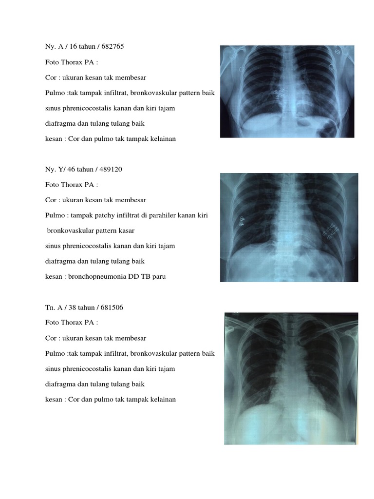 Tugas Radiologi Rayadi 12 Januari 2019 | PDF