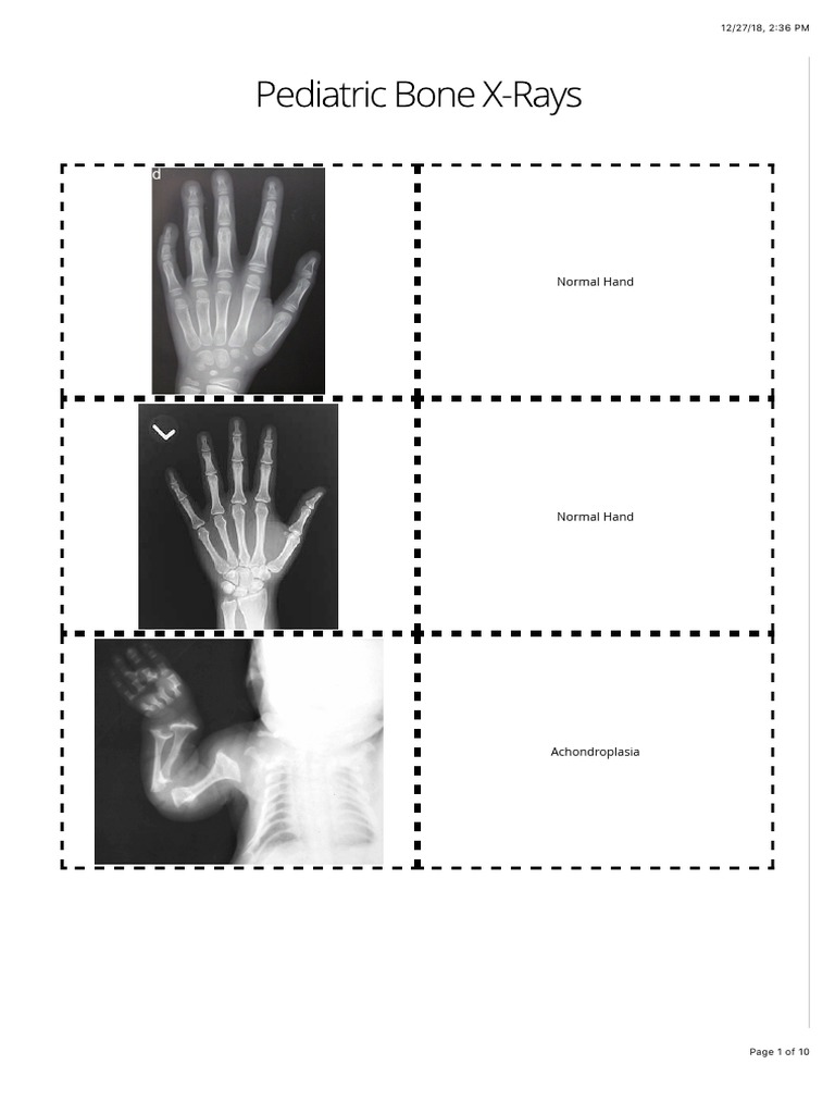 Pediatric Bone Disorders Guide | PDF | Musculoskeletal System | Human ...