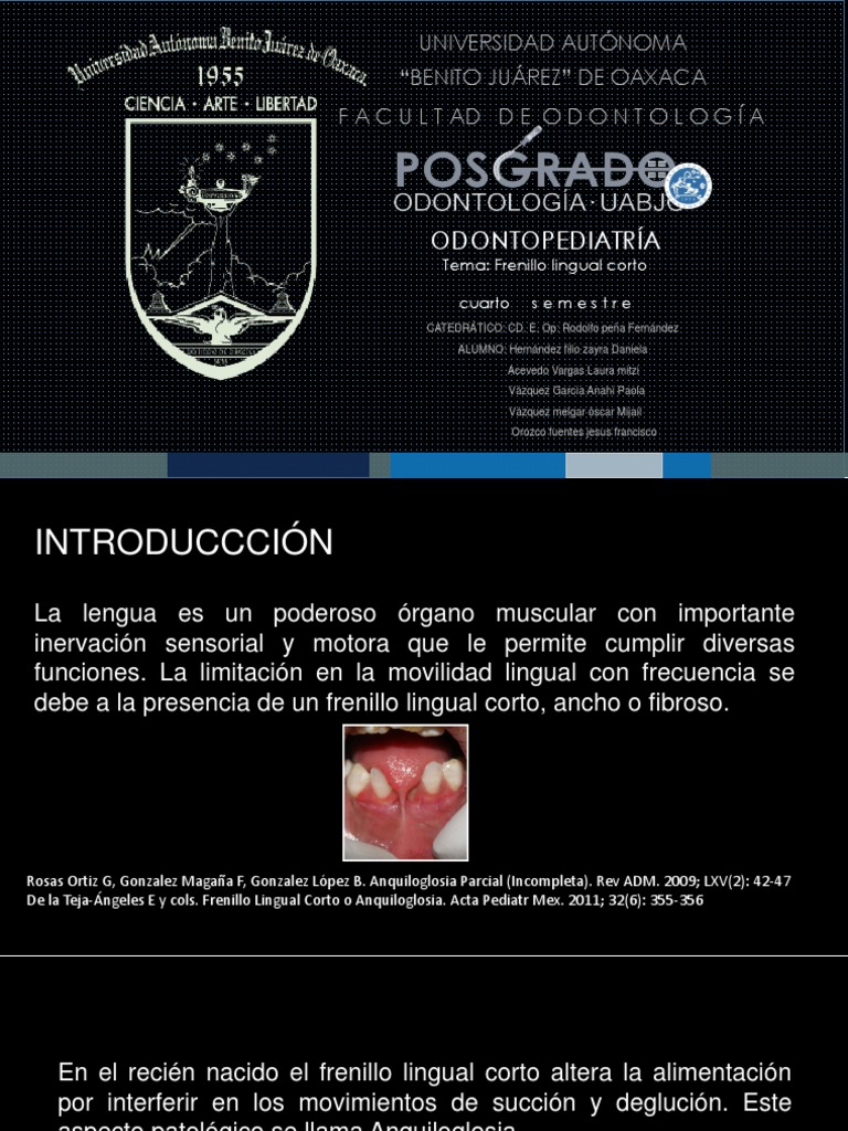 Frenillo Lingual Corto: Clasificación y Tratamiento | PDF | Boca ...