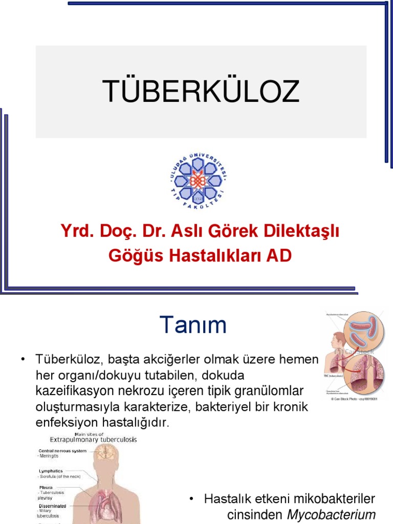 TÜBERKÜLOZ | PDF