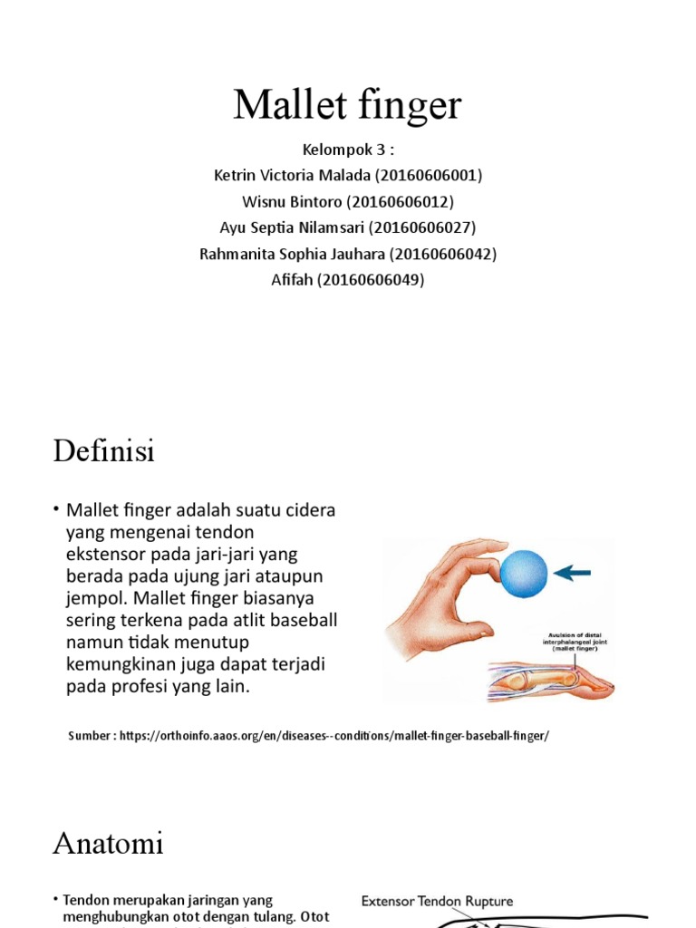 Mallet Finger | PDF | Sains & Matematika