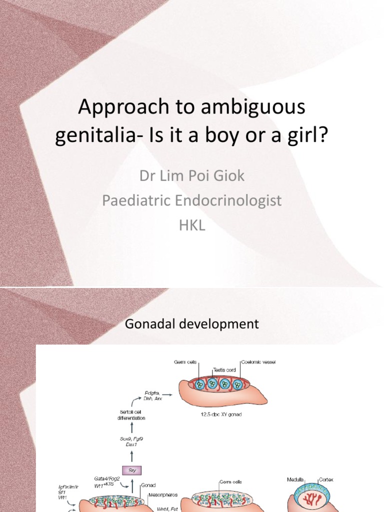 26.7.16-Approach to ambiguous genitalia -Is it a boy or girl.pdf ...