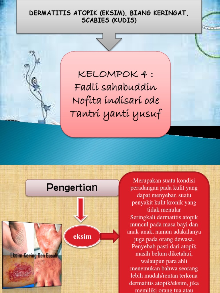 Jenis-jenis Kudis dan Eksim pada Kulit | PDF