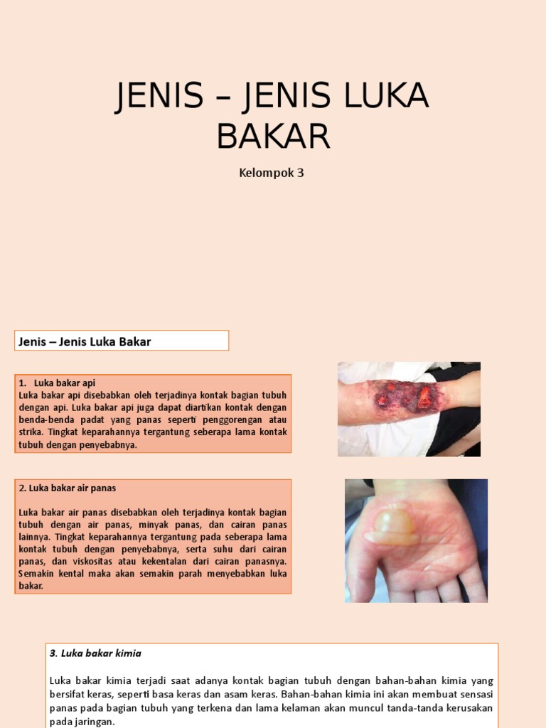 Jenis - Jenis Luka Bakar | PDF