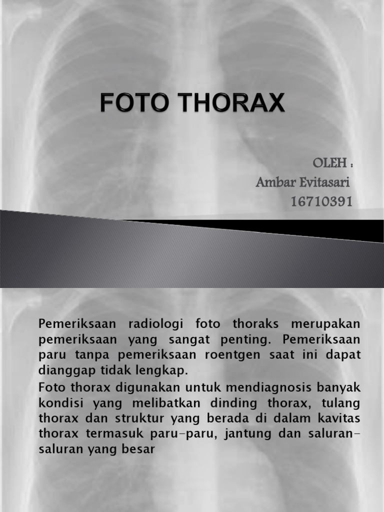 Foto Thorax | PDF