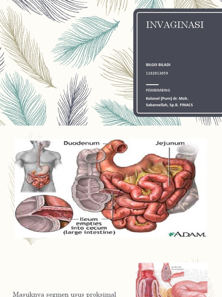 Invaginasi Usus | PDF