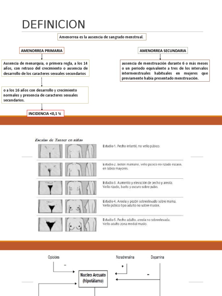 Amenorrea Primaria | PDF | Menstruación | Reproducción humana