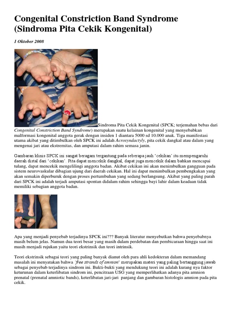 Congenital Constriction Band Syndrome | PDF