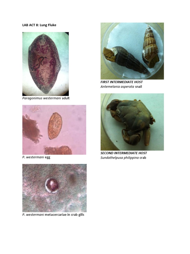 LAB ACT 8 - Lung Fluke PDF | PDF | Pathology | Parasites