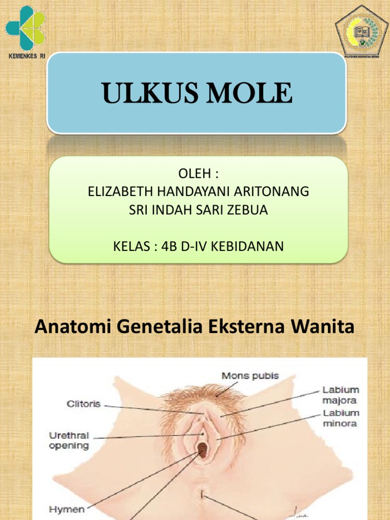 Ulkus Mole New | PDF