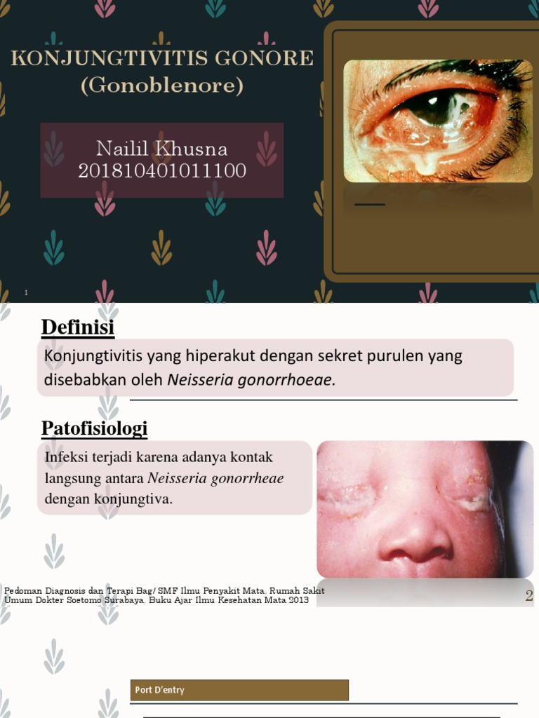 Konjungtivitis Gonore: Diagnosis dan Terapi | PDF | Sains & Matematika
