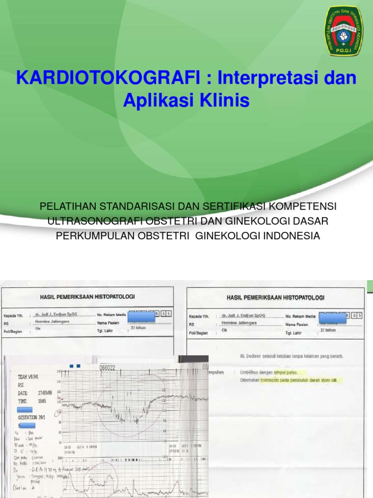 POGI, USG, 2014, Yogya, 15. Kardiotokografi, Interpretasi Dan Aplikasi Klinis, 2 | PDF ...