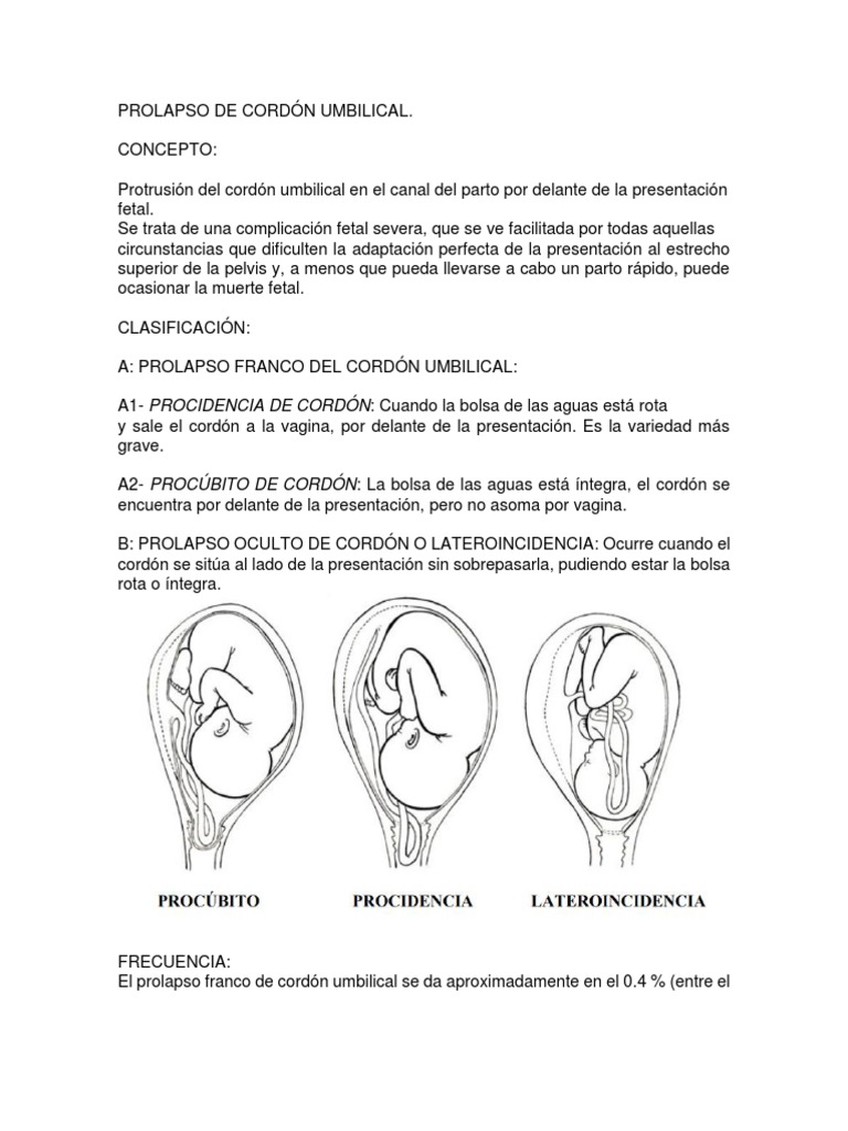 Prolapso de Cordón Umbilical | Parto | Medicina