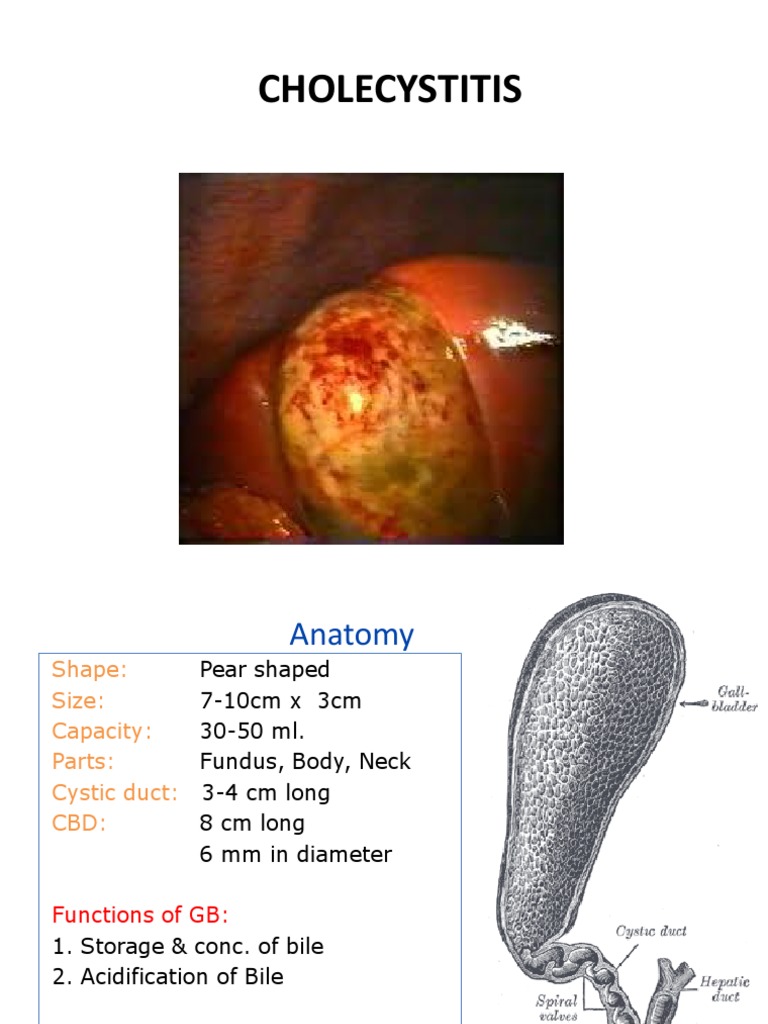 Chole Cystitis | PDF | Gallbladder | Digestive Diseases
