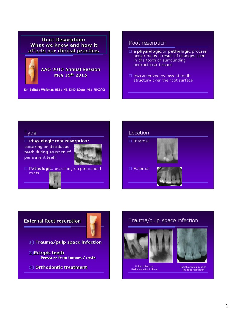 Root Resorption What We Know and How It Affects Our Clinical Practice ...